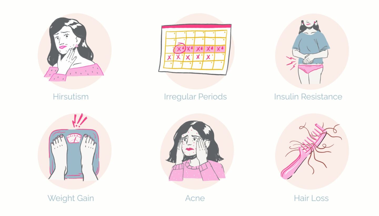 What Is PCOS? Symptoms, Causes & Diagnosis | Dr Peter Jurcevic